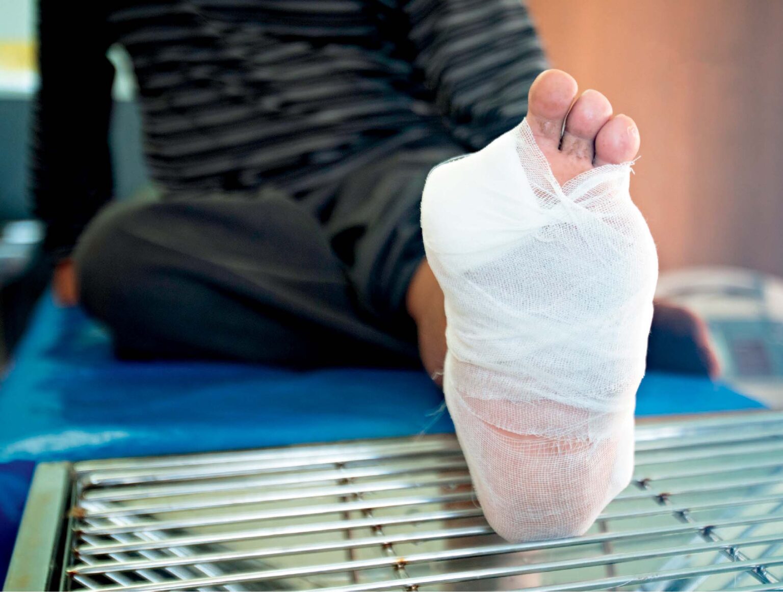 Dijabetičko stopalo je vodeći uzrok amputacija u svijetu ...